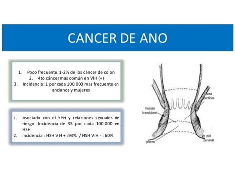Cáncer de colon, recto y ano