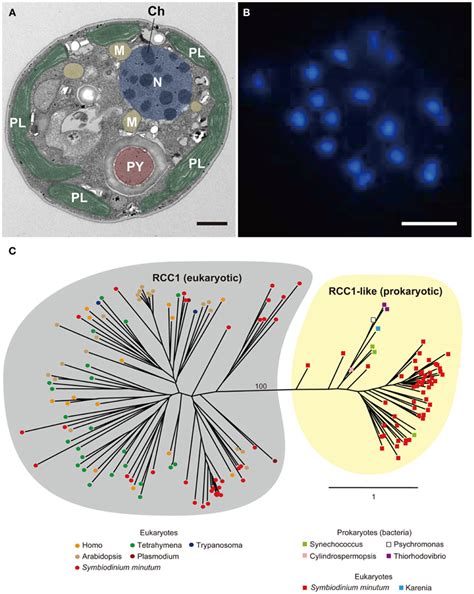 A Electron Micrograph Showing Permanently Condensed Chromosomes Ch