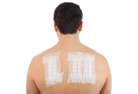 Prick Test Patch Test E Rast Em Guarulhos Prick Test Patch Test E