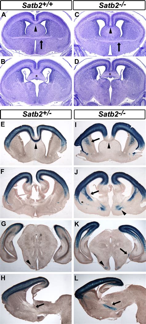 Satb2 Regulates Callosal Projection Neuron Identity In The Developing Cerebral Cortex Neuron