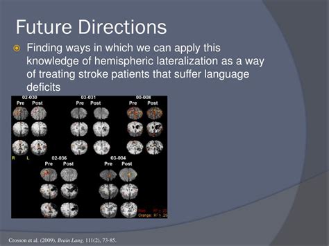 Ppt Degree Of Language Lateralization Determines Susceptibility To