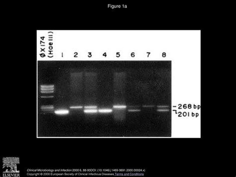 Chlamydia Trachomatis And Human Papillomavirus Infection In Indian Women With Sexually