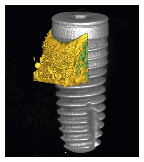Three Dimensional Micro Ct Reconstructed Images A C E Block Download Scientific Diagram