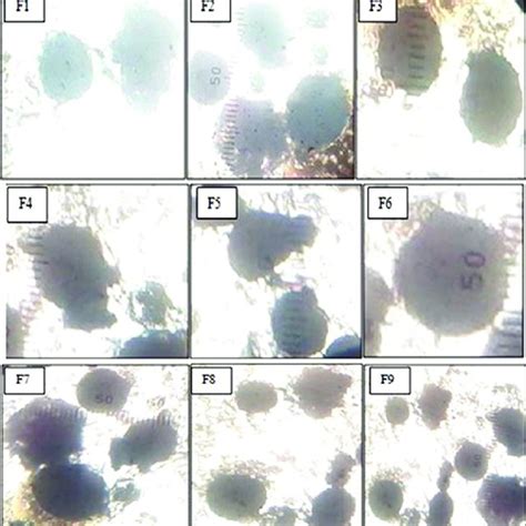 Microscopic Image Of Spherical Agglomerate Formulations Download