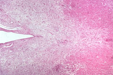 00001774 Peir Digital Library