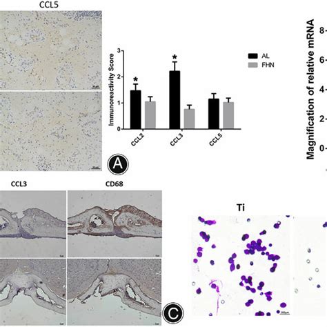 A The Immunohistochemical Staining Of Ccl2 Ccl3 And Ccl5 Of Hip