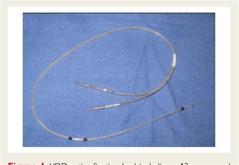 Figure 2 From Temporary Transvenous Vdd Pacing As A Bridge To Permanent