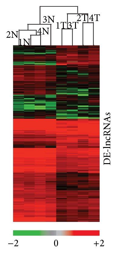 Transcriptomic Landscape Of Esophageal Squamous Cell Cancer Escc A