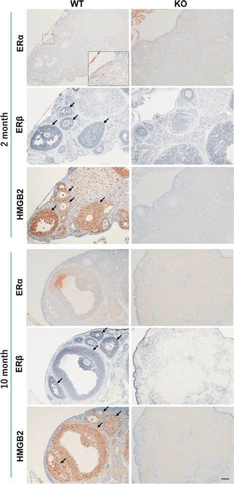 Localization Of Ers Immunohistochemical Localization Of Erα Erβ And