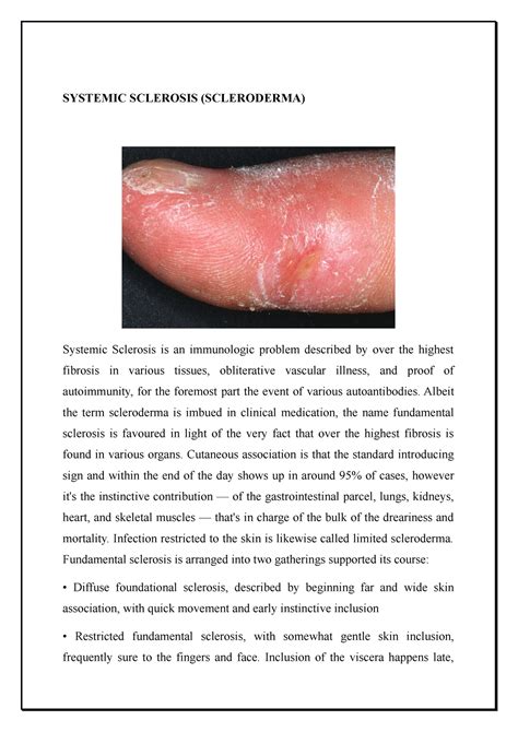 Systemic Sclerosis Scleroderma Systemic Sclerosis Scleroderma