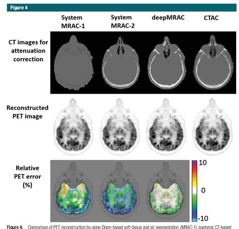 Figure 1 From Deep Learning Mr Imagingbased Attenuation Correction For