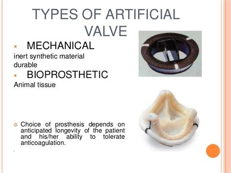 Prosthetic Valve Replacement
