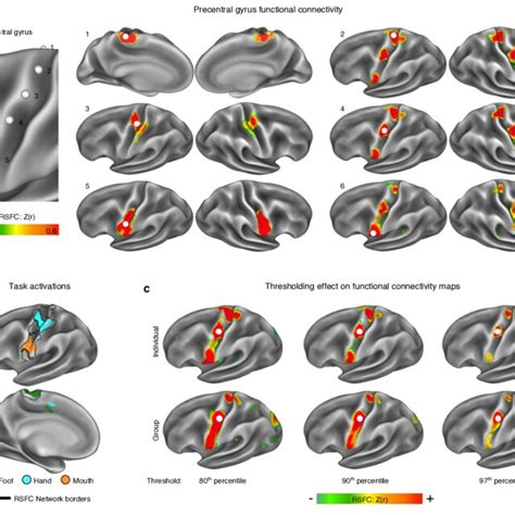 Precision Functional Mapping Of Primary Motor Cortex A Resting Download Scientific Diagram