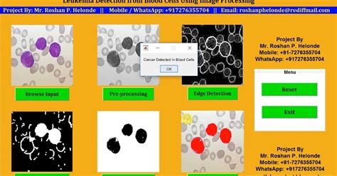 Leukemia Blood Cancer Detection Using Image Processing Matlab Source Code ENGINEERING PROJECTS