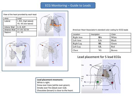 PPT Normal Measurements PR Interval Sec QRS Complex Less Than Sec