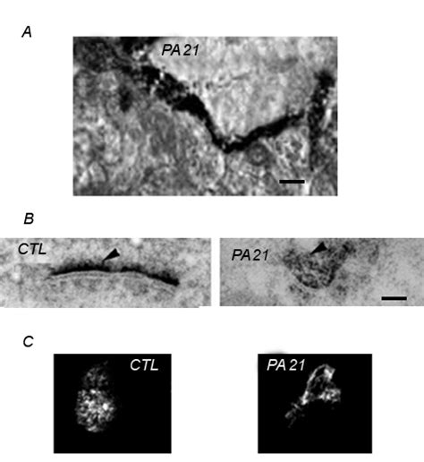 synaptic modification induced by perinatal asphyxa a neostriatal