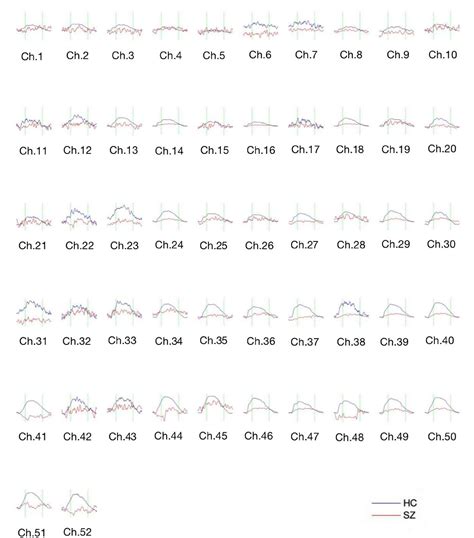 Figure 3 From Classification Of Schizophrenia By Functional Connectivity Strength Using