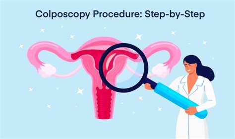 Colposcopy Test Procedure Steps Cost Side Effects And Result