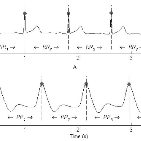 Pdf Comparison Between Heart Rate Variability And Pulse Rate