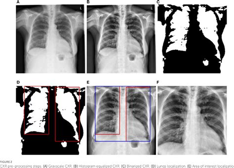 Figure 1 From Unsupervised Domain Adaptation For The Detection Of