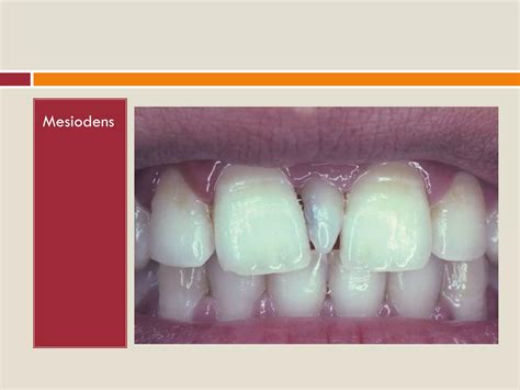 Developmental Disturbances Of Tooth Morpology Pdf