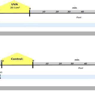 Indicative Representation Of Plasma And Urine Collection Schematic At