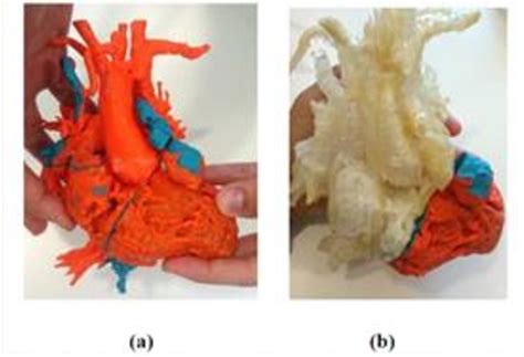 Figure 1 From Surgical Planning Using The Additive Manufacture