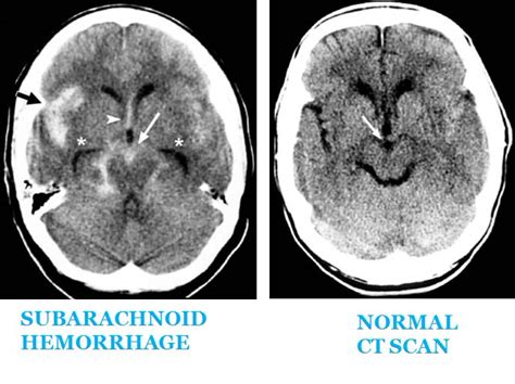 Mbbs Medicine Humanity First Ct Scan Of Head