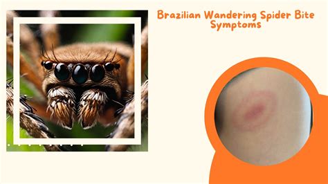 17 Types Of Spider Bite Symptoms Id With Pictures