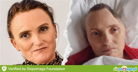 Ewa Buczek Zbiórka Charytatywna Siepomagapl