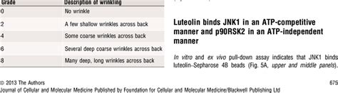 Grading Scheme For Assessment Of Wrinkle Formation Download Table