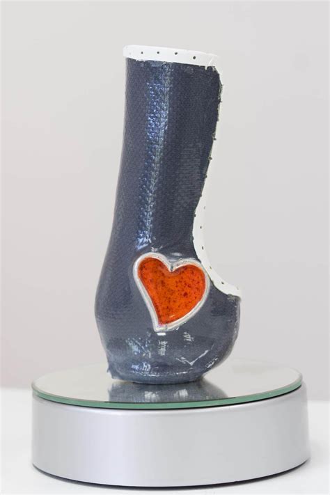 Протези за крака долни крайници Ortomedics