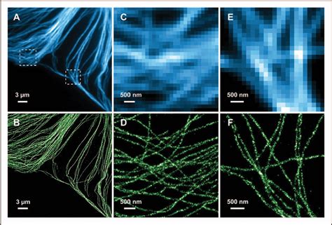 Figure 1 From Review Of Super Resolution Fluorescence Microscopy For Biology Semantic Scholar