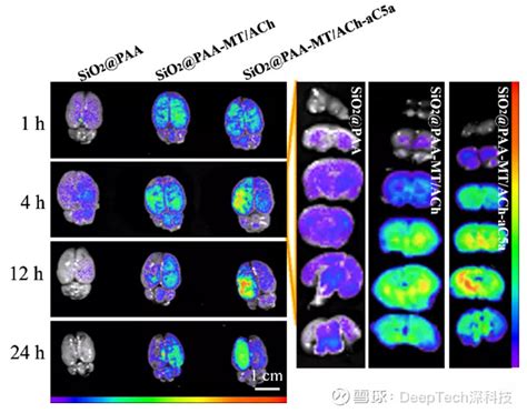 重医大团队打造二氧化硅 纳米信使”，让脑缺血再灌注损伤治疗迎新希望 对于脑卒中的研究，也有一部分个人因素在里面。我的父亲因为脑卒中而突然去世，也是因为这个病我没能见上父亲最后一面，这一直