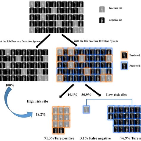 Impact Of The Rib Fracture Detection System In Clinical Practice For Download Scientific