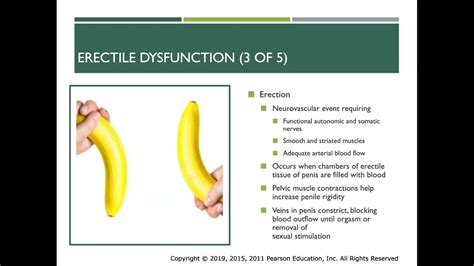Sexual Dysfuntions Lecture Youtube