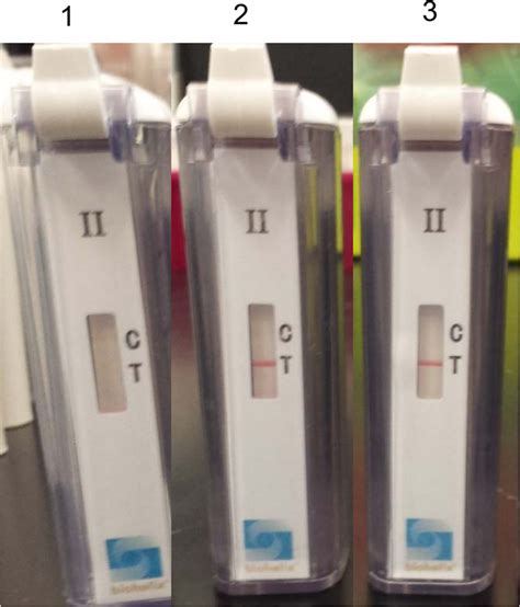 Evaluation Of Rpa Nfo Assay Using Xcp Cassette The Rpa Nfo Assay For
