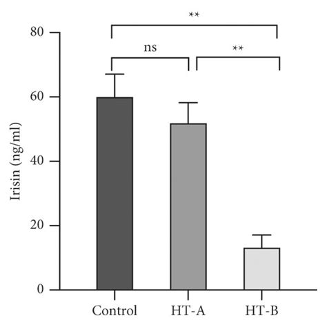 Roc Curve Analysis Of Irisin To Predict Pericardial Effusion In Severe