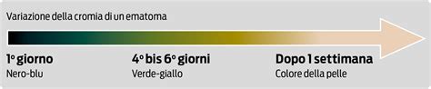Ematomi Guida Alle Cause Ai Sintomi E Al Trattamento