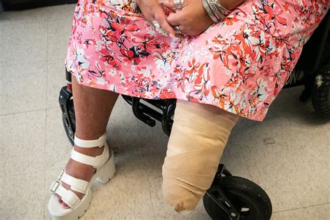 City Sets Standard For ‘tranq Treatment But Federal Help Is Needed