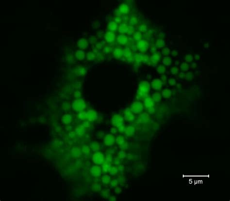 Fileinduction Of Protein Body Formation In Plant Leaves By Elastin