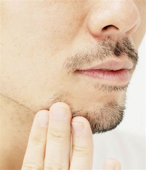 남자 수염 종류 수염발모제 미크로겐 남자수염기르기 사용법 네이버 블로그