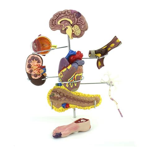 Anatomy Models Human Anatomy Science Models Diabetes Organ