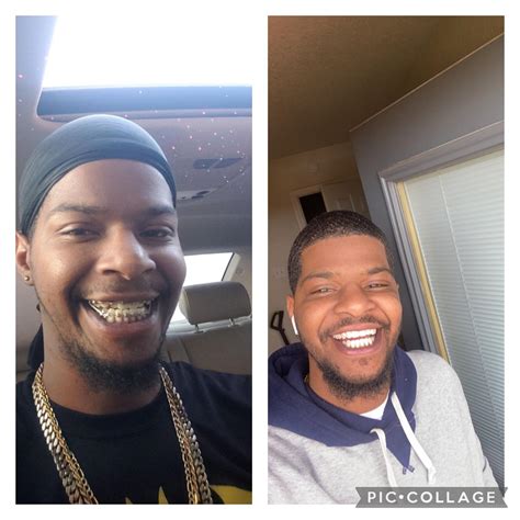As Promised Im Braces Free Scrolller