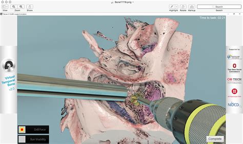 A Review Of Simulation Applications In Temporal Bone Surgery Kashikar 2019 Laryngoscope