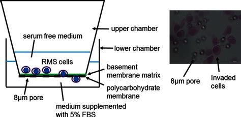 Principle Of The Matrigel Invasion Assay The Matrigel Invasion Chamber