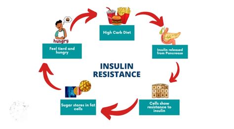 Insulinresistance Dr Uma Vaidyanathan