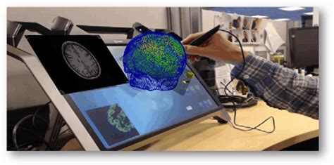 Modeling Simulating Optimizing Medical Devices Todays Medical Developments