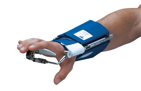 Finger Splint Dynamic Vs Static Smashwes
