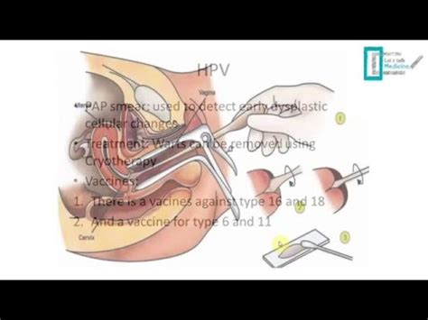 STDs Overview YouTube